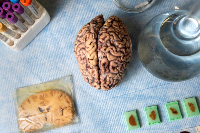 Brain Donation Modules